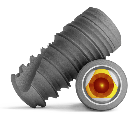 Bi phase implants | BIONIKA