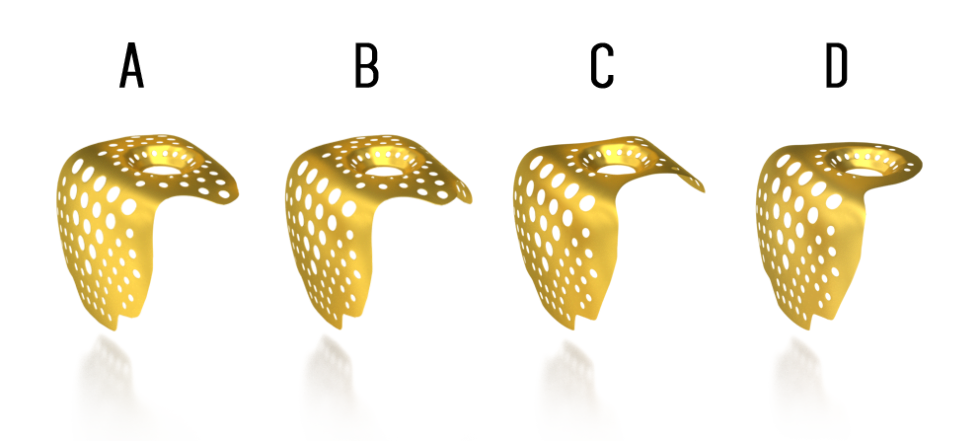 3D Builder Titanium membrane, the new generation of bone augmentation ...